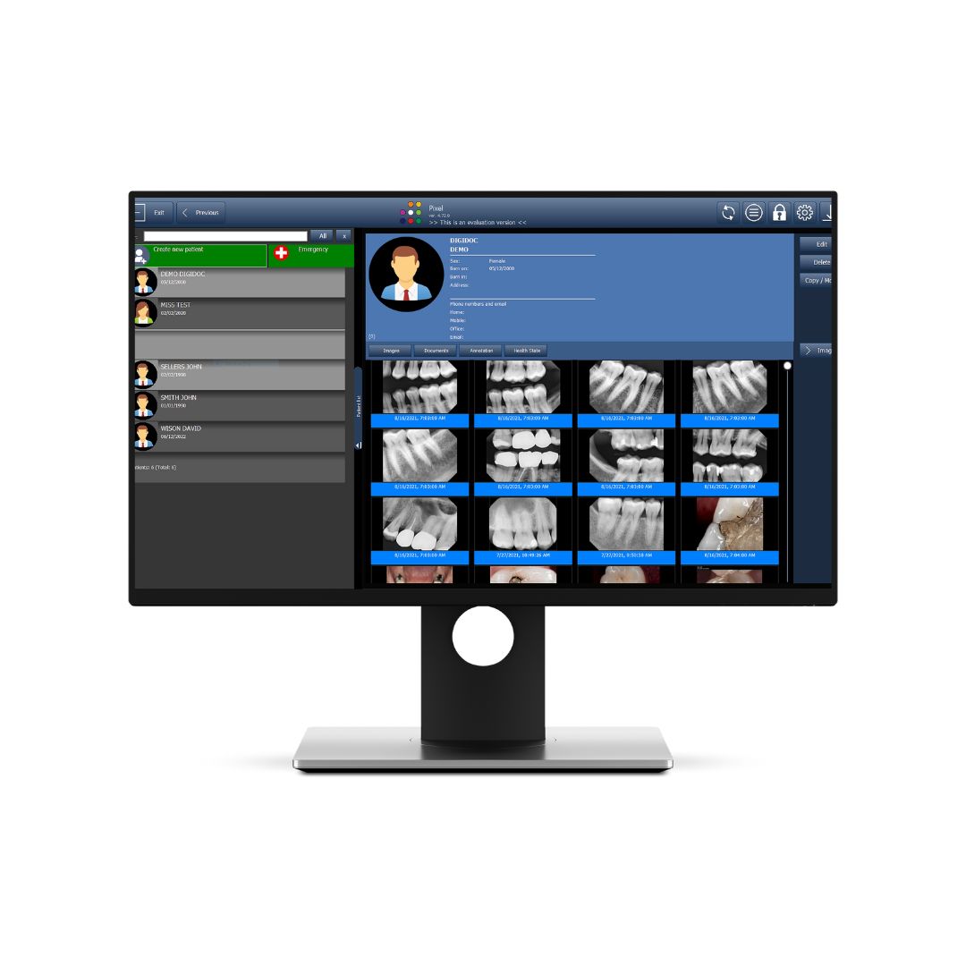 SPECIAL OFFERS - Digital Doc #1 INTRAORAL CAMERA FOR DENTISTS